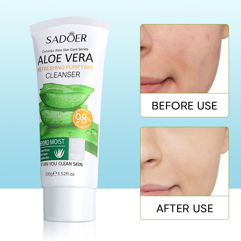 ROREC SADOER Aloe Vera Refreshing Purifying Cleanser Refreshing Moisturizing Foaming Cleanser ...