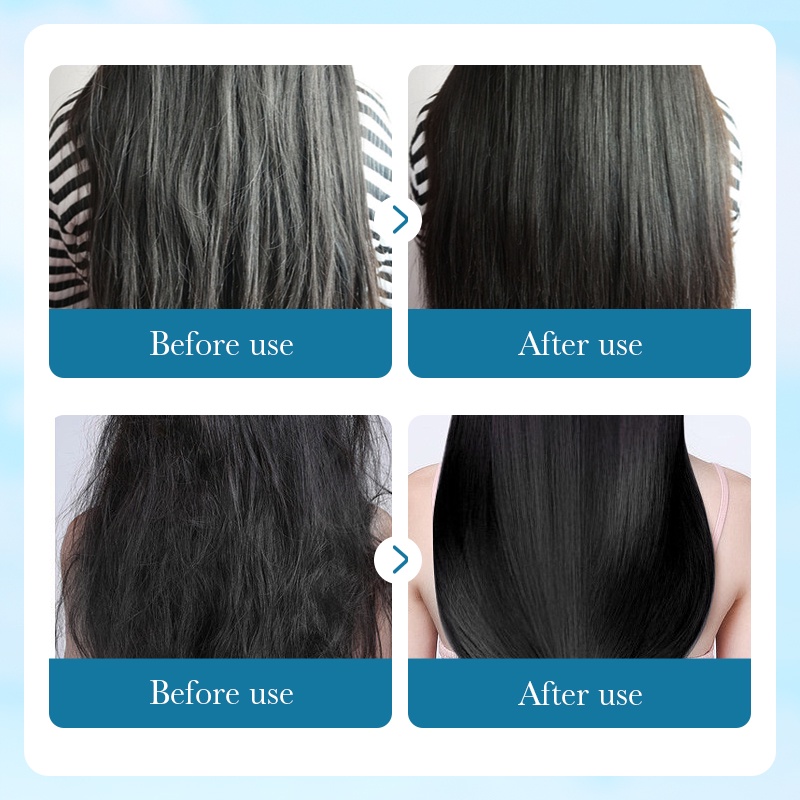 ROREC SADOER Aloe Vera Anti Dandruff Repair Shampoo Anti-Itch Oil Control Shampoo 500ml | Shopee ...