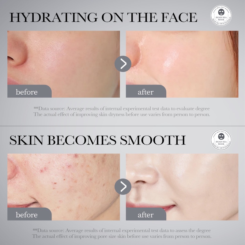 BIOAQUA Dead Sea Mud Whitening Mud Mask Deep Cleansing Shrinks Pores ...