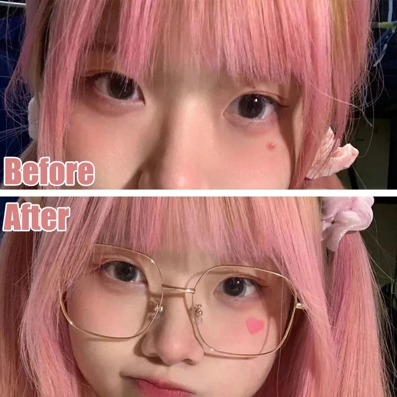 Colorful Love Stars Acne Patch / Breathable Face Spot Stickers / Flower ...