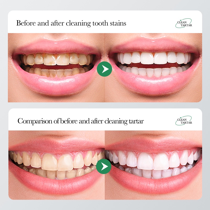 BIOAQUA Hyaluronic Acid Nicotinamide Baking Soda Deep Clean Toothpaste ...
