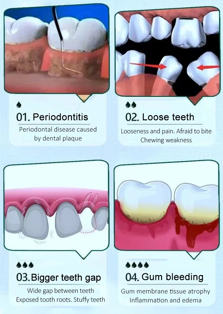 [MY Stock📦️]Progressive Restoration Gum Protect Therapy Gel/Teeth ...