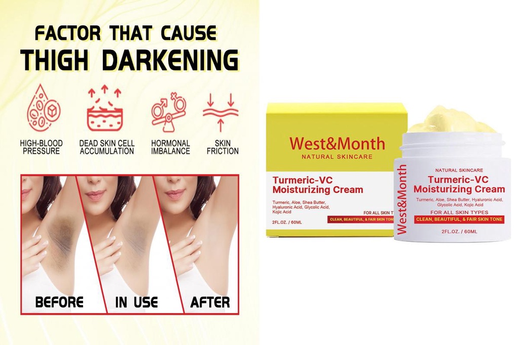 GRE Whitening Cream for Dark Spots Skin Conditioning Whitening Cream ...