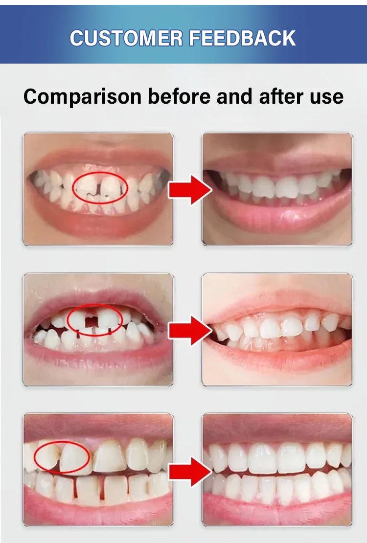[MY Stock📦️]Progressive Restoration Gum Protect Therapy Gel/Teeth ...