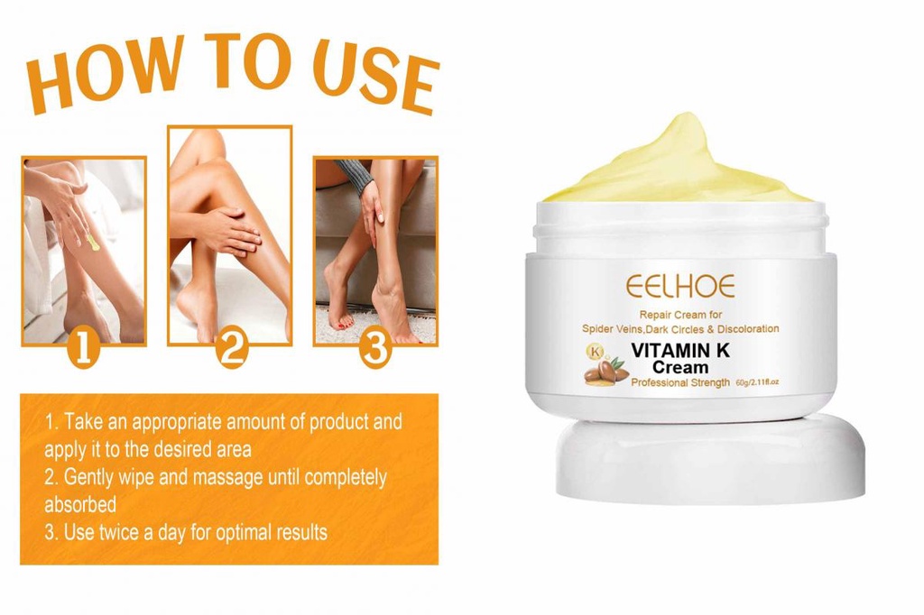 GRE Varicose Vein Leg Cream Natural Varicose Vein Cream for Healthy ...