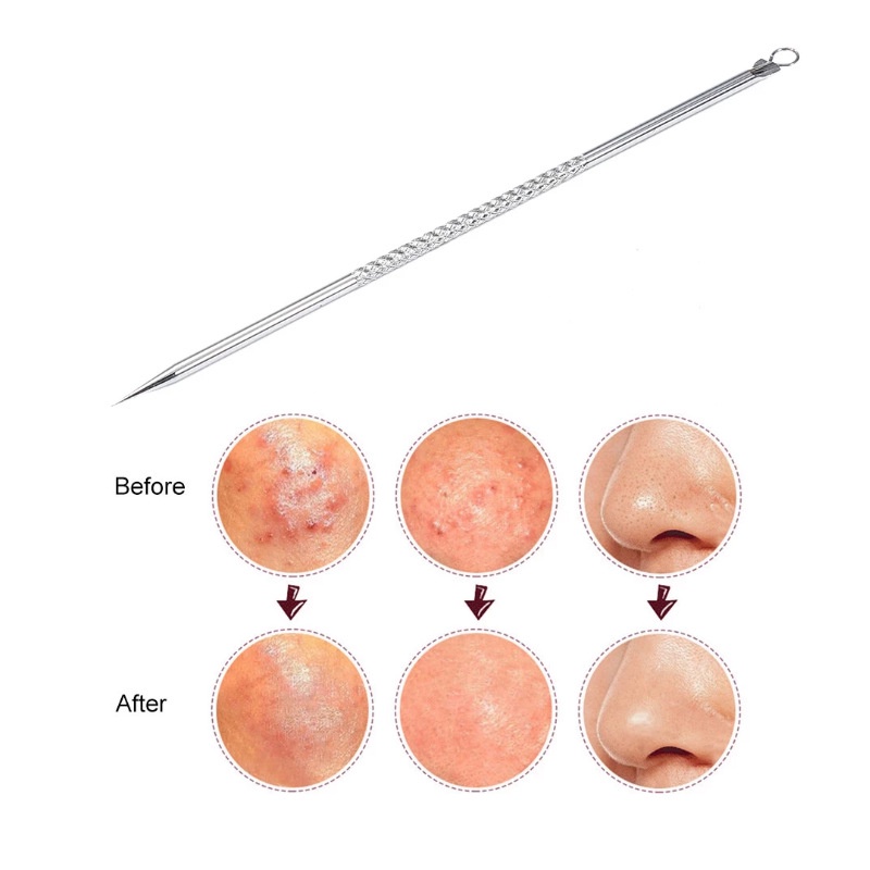 Pimple Kit Set Stainless Steel Pimple Tools Extractor Needle Blackhead ...