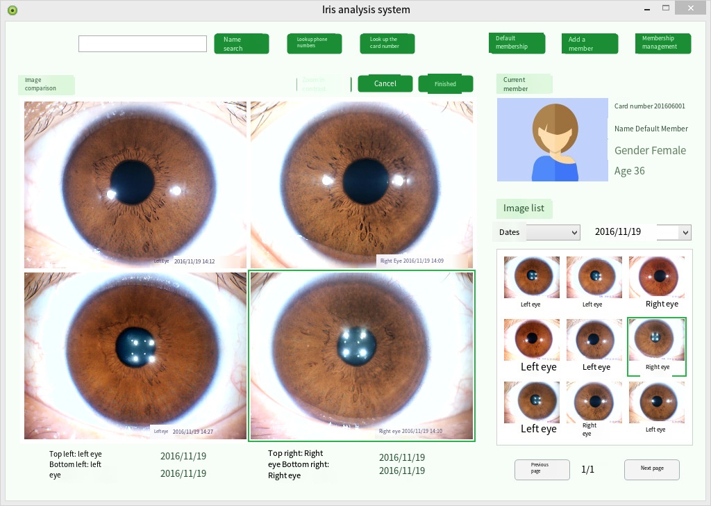 Digital Iridology Camera Iridology Analyzer Iris Analyzer Device Iris ...