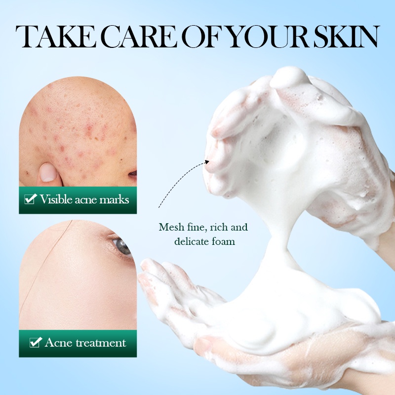 ROREC SADOER Tea Tree Acne Oil Control Face Clean Mousse Cleanser Anti-Acne Hydrating ...