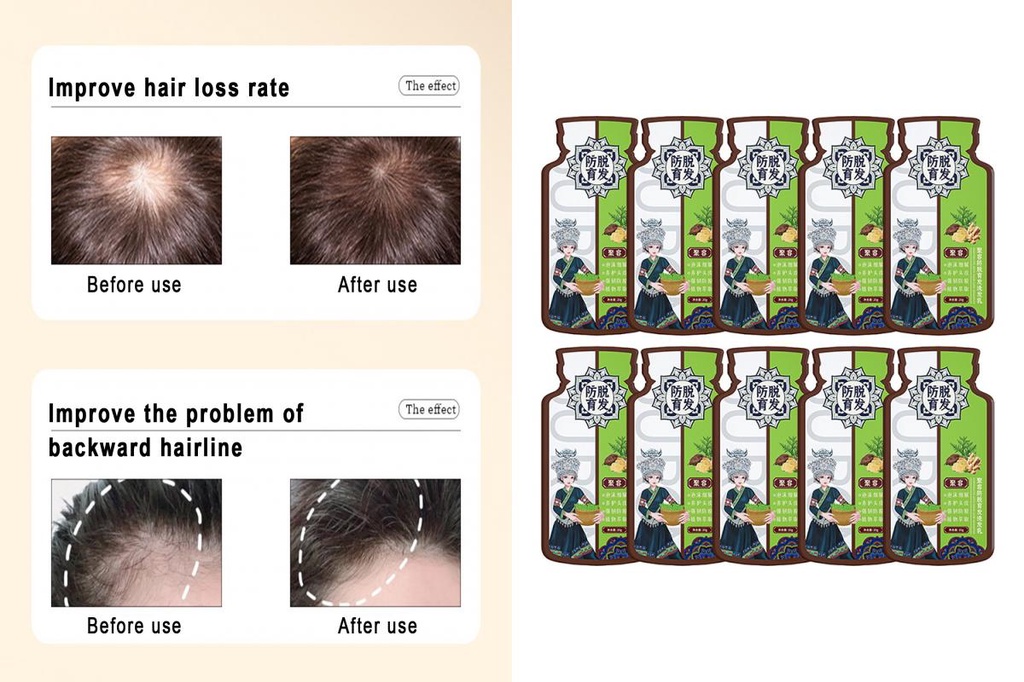 Han Ginger Plant Extract Shampoo Ginger Hair Care Shampoo 20ml Ginger ...