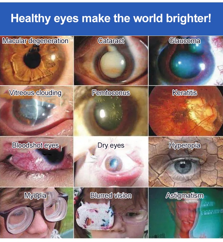 Ubat titisan mata rabun Jepun Ophthalmology mengesyorkan rawatan ...