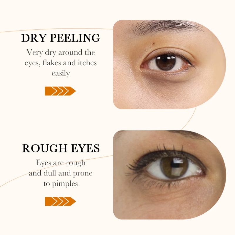 BIOAQUA Rice Raw Pulp Eye Mask Moisturizing Reduce Dark Circles and Eye Bags 80g(60pcs) | Shopee ...