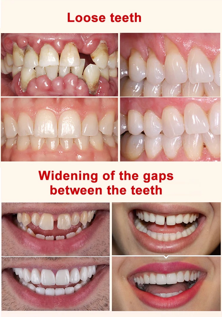 [MY Stock📦️]Progressive Restoration Gum Protect Therapy Gel/Teeth ...