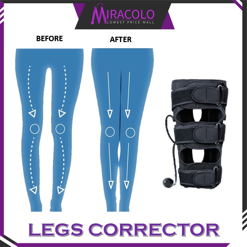MIRA Leg Corrector O-Type Leg Correction Belt Beam Strap Leggings ...