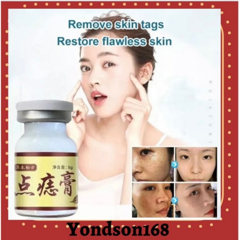 Y82 Concentrated potent skin tag removal cream Mole Cream No Mark ...