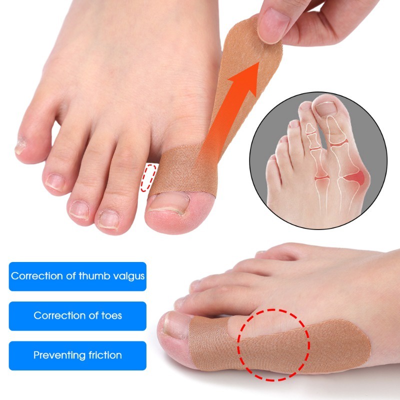 10 Pcs Big Toe Eversion Correction Patch / Thumb Tendon Sheath Sticker ...