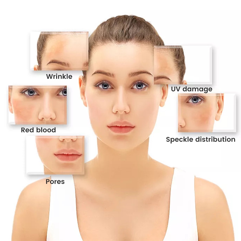 Wireless Dermatoscope Scalp Skin Analyzer Machine 1000X Facial and Body ...