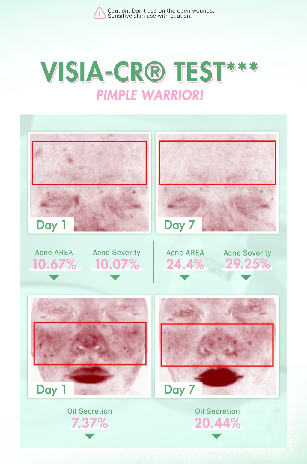 barenbliss BNB Pimple Warrior Salicylic Acid Acne Drying Lotion Triple ...