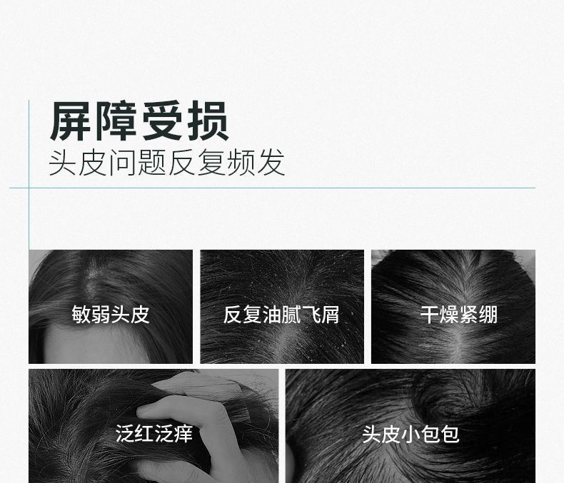 CLINITECH Scalp科丽尼头皮素 Sensitive Repair Anti-Dandruff Oil Control Fluffy ...