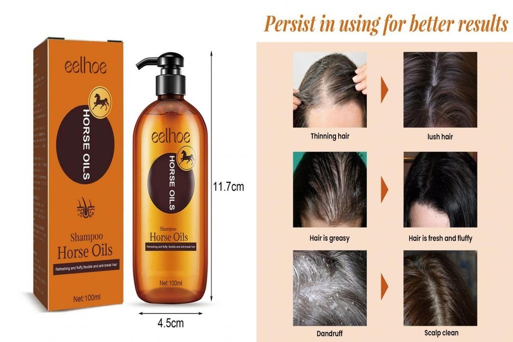 GRE Shampoo for Healthy and Strong Hair Horse Oil Shampoo for Hair Loss ...