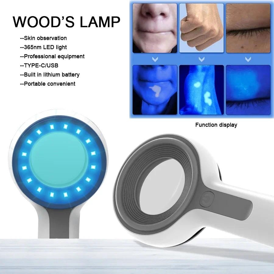 Rechargeable Wood's Lamp Skin Examination Test Medical Diagnostic ...
