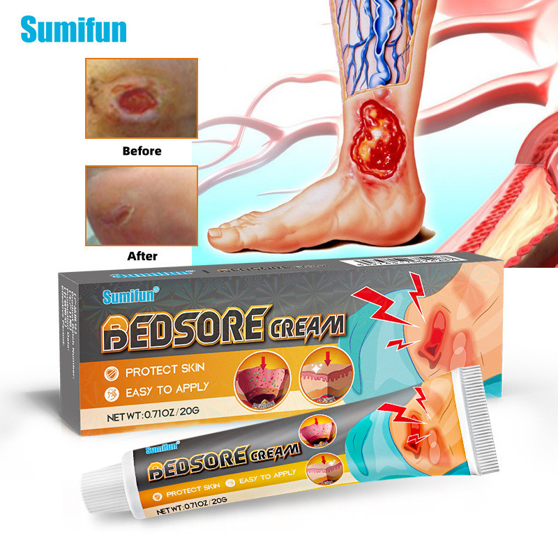 Bedsore Treatment Cream Pressure Sore Ulcer Skin Rot Necrotic repair ...