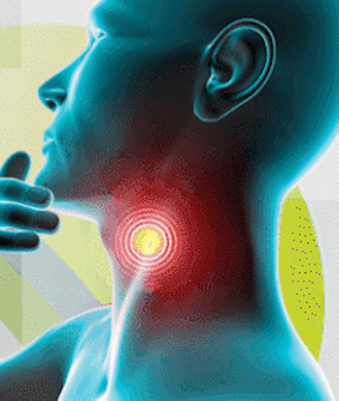 【Relieve pharyngitis】Medical Throat Coating Gel/Relieve Pharyngitis ...