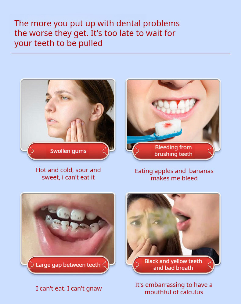 [Oral hygiene care] Dental Spacing Agent / Orthodontic Separation Gel ...