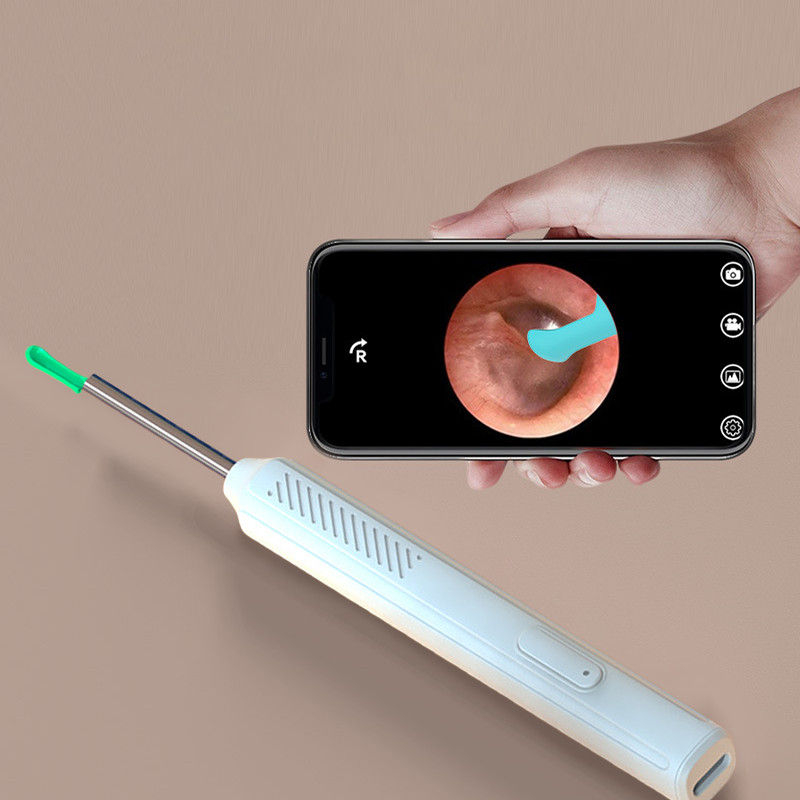 Smart Visual Earpick Wireless With HD Camera Earwax Removal Kit Baby ...