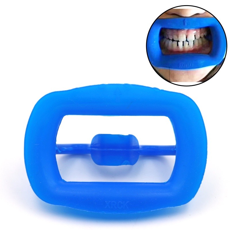 Dental Intraoral Mouth Opener Cheek Lip Retractor 3D Mouth Opening ...