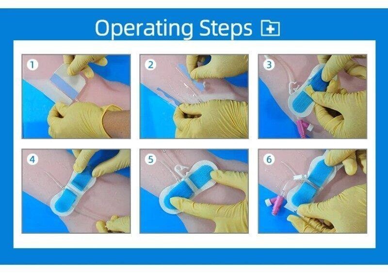 PICC Medical Sterile Catheter Fixation Patch Tape Catheter Stable ...