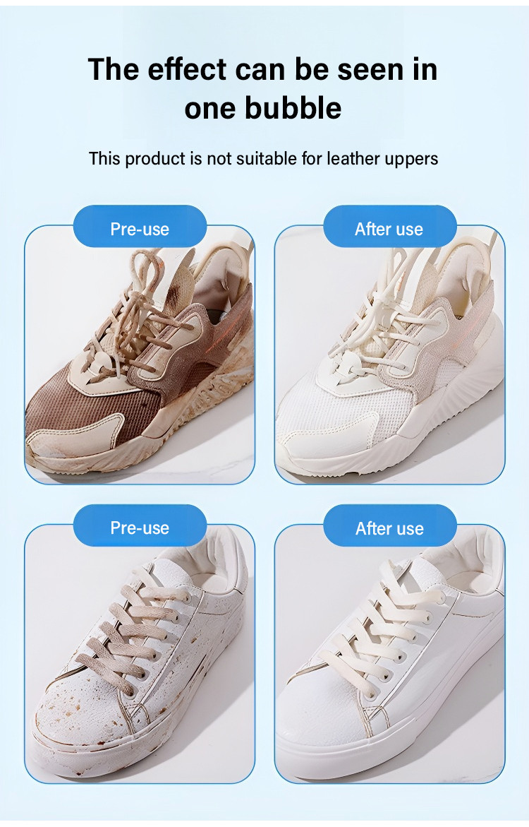 【Ready Stock】[Newly Developed by Japanese Doctors] All-Purpose Stain ...