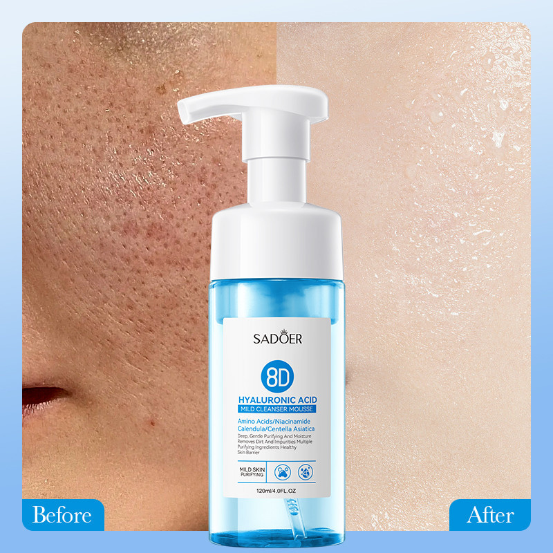 ROREC SADOER 8D Hyaluronic Acid Mild Cleanser Mousse Amino Acid Niacinamide Deep Gentle ...