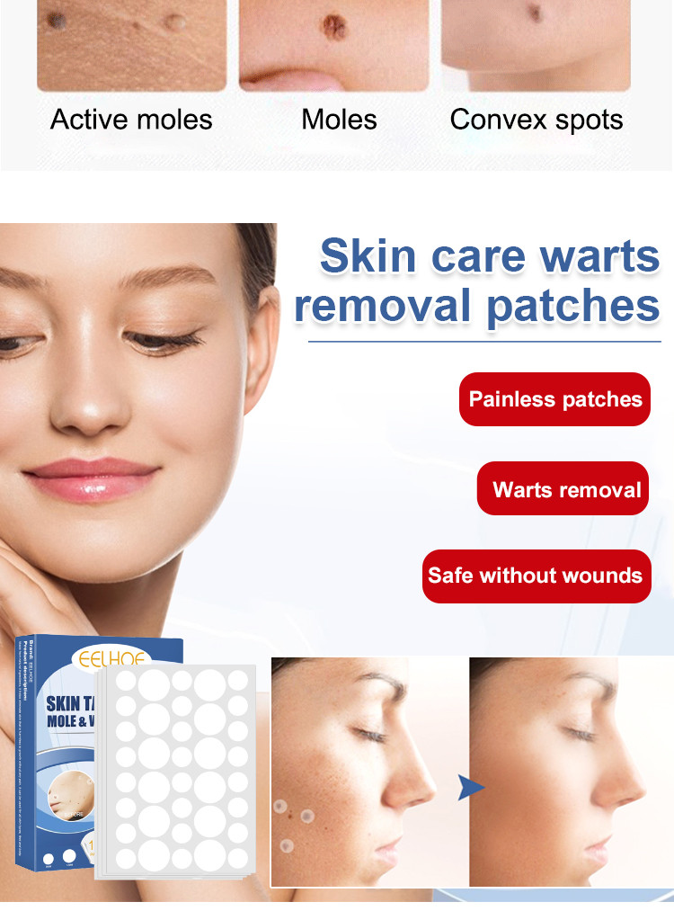 Wart Patch Smooth and Flatten Skin Warts Corns and Calluses | Shopee ...