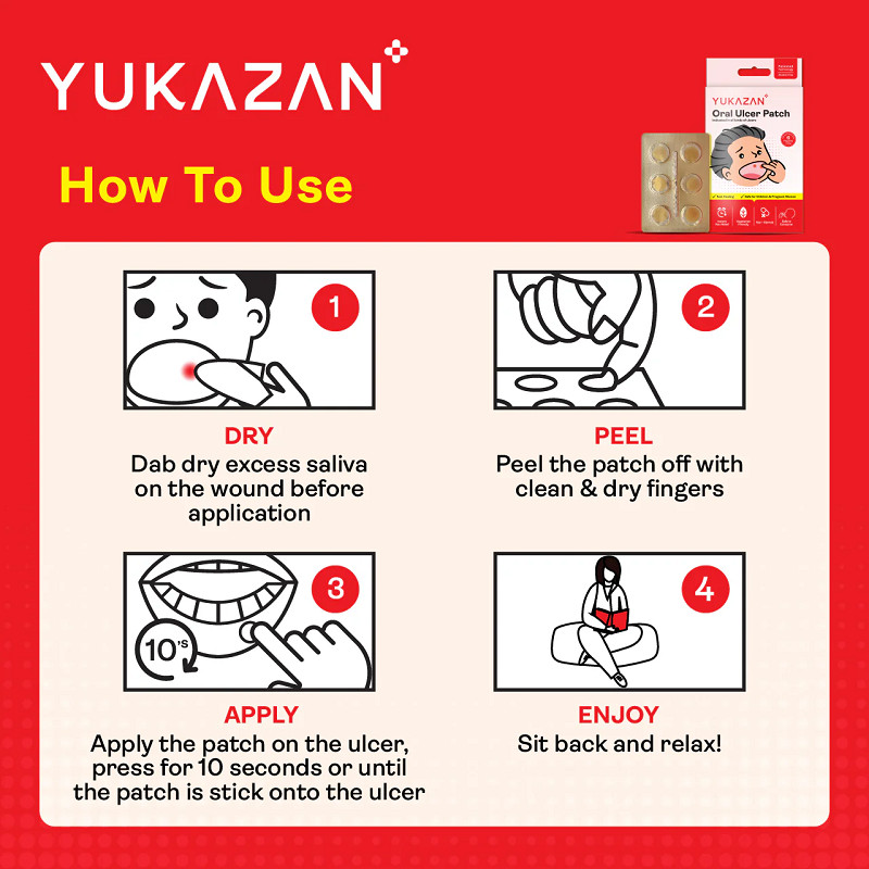 Yukazan Oral Ulcer Patch (6 pieces) - For all kind of oral & canker ...
