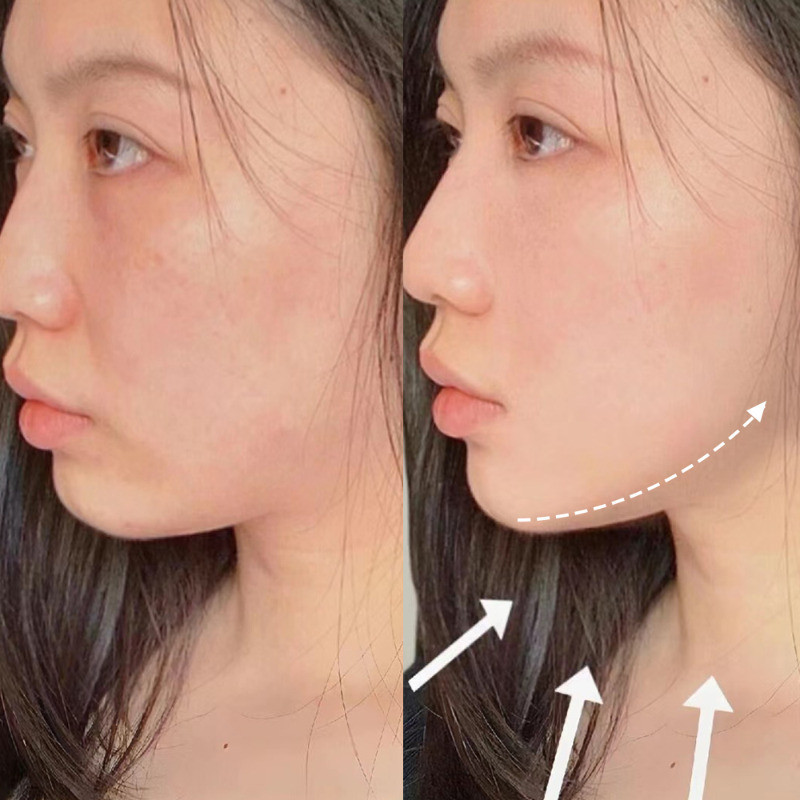 Double-Deck Facial Slimming Bandage - Breathable V Face Band - Face ...