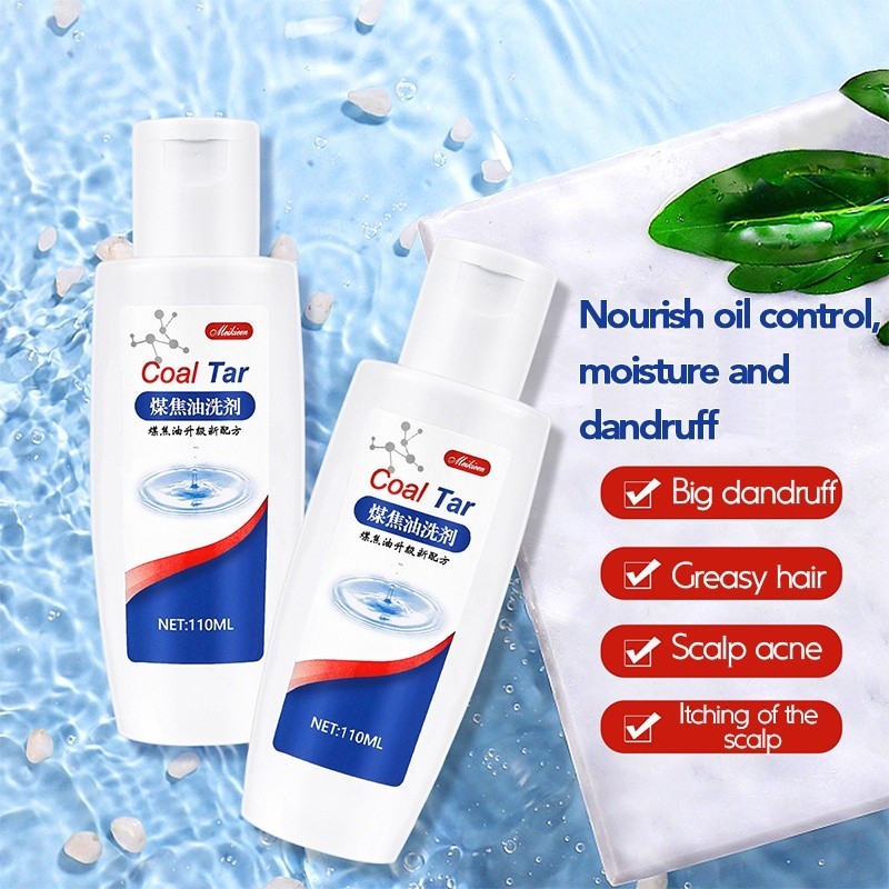 110ML Coal Tar Lotion Anti-dandruff Anti-itch Antibacterial Liquid Shampoo for Seborrheic ...