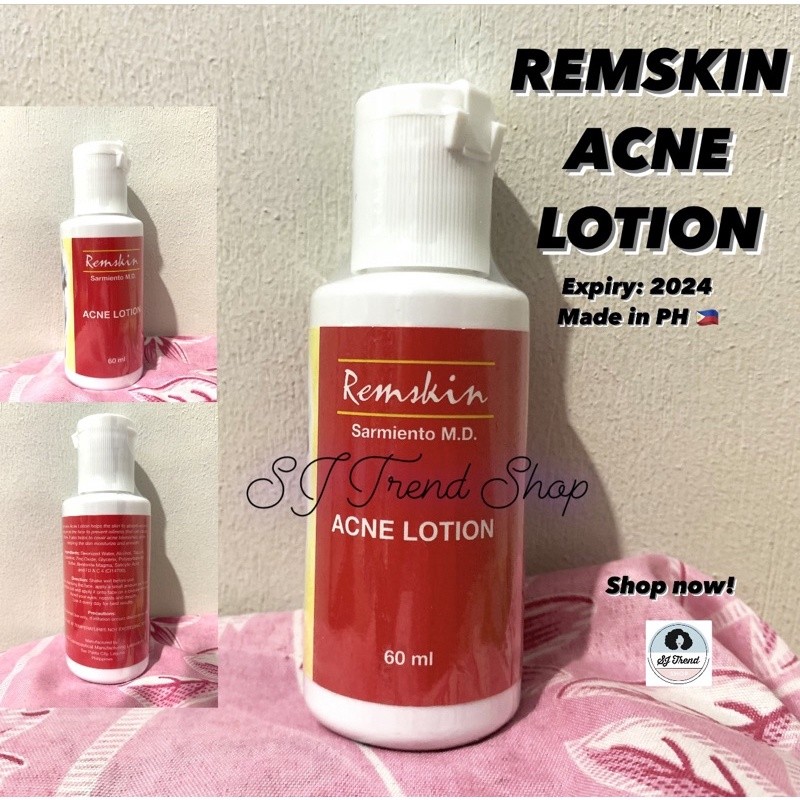 Acne Lotion Treatment for Acne / Pimples | Shopee Malaysia