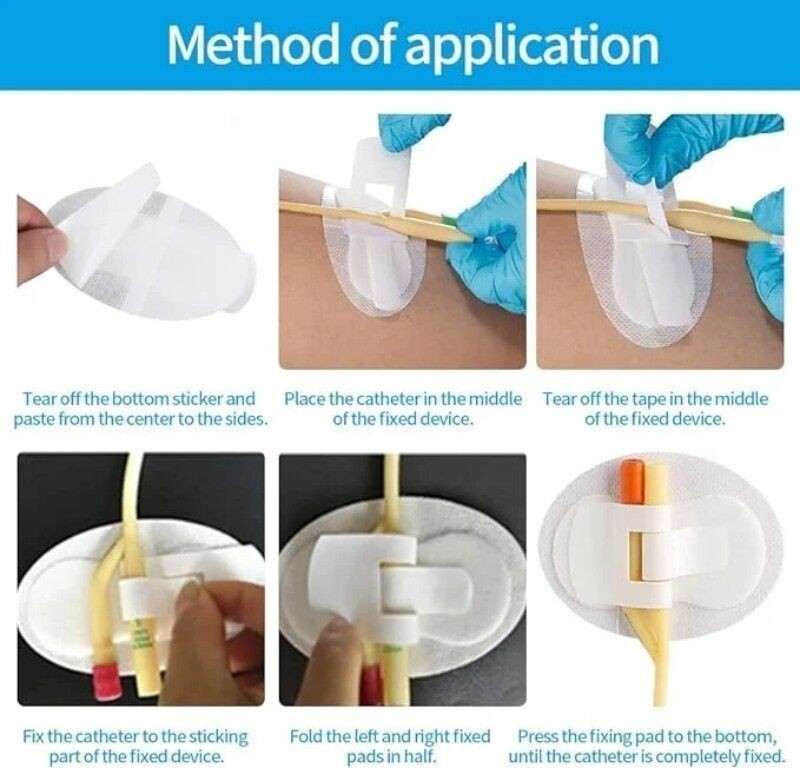 Drainage tube holder Urinary catheter stent Legband Fixation Stickers ...