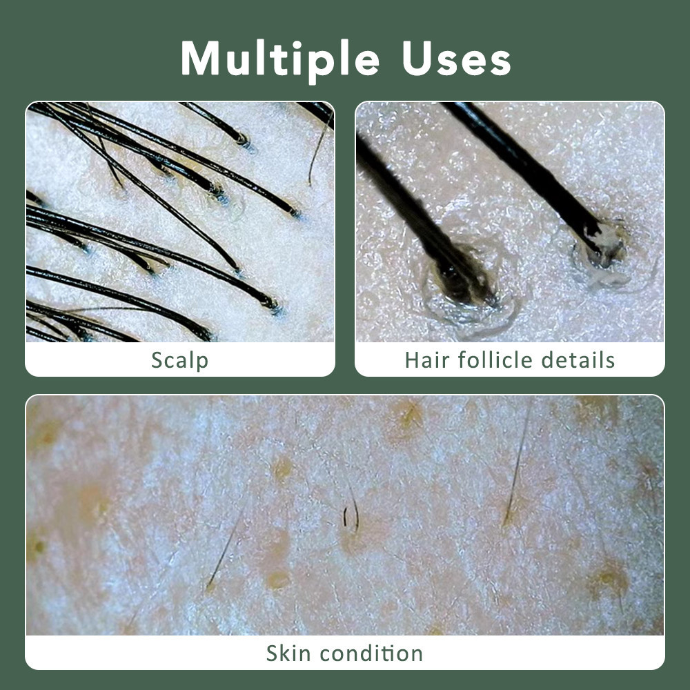 Portable HD Scalp Follicle Skin Analyzer Blackhead Pore Detection ...