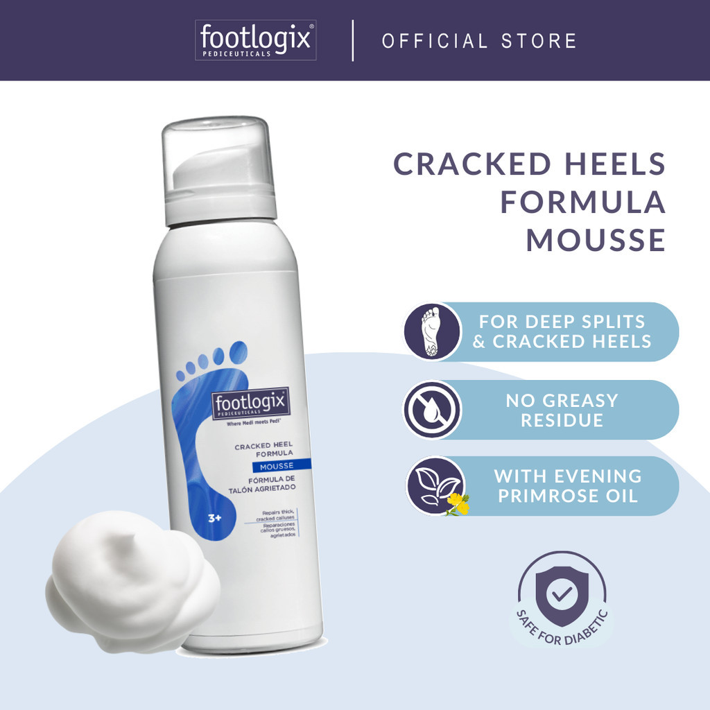 FOOTLOGIX Cracked Heel Mousse Formula #3+ - Foot Care | Shopee Malaysia
