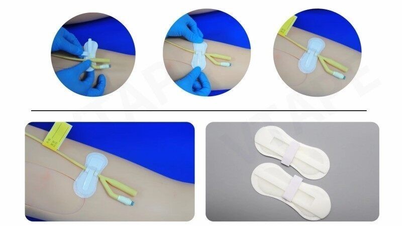 Drainage tube holder Urinary catheter stent Legband Fixation Stickers ...