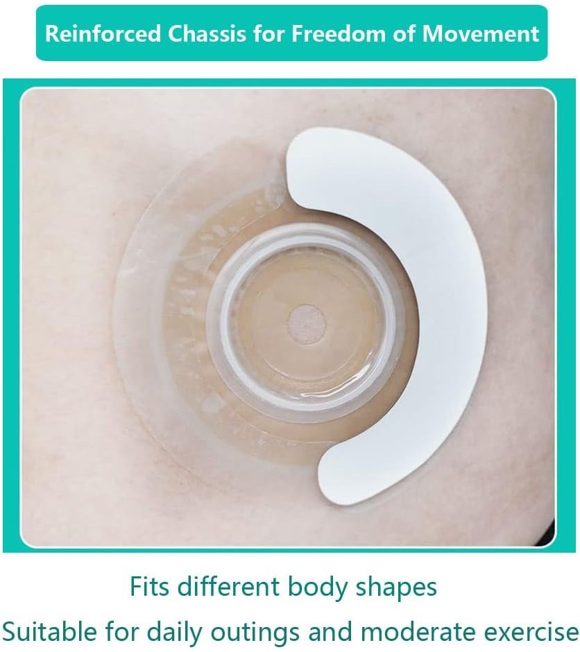 Ostomy Bag Flange Barrier Strips 20/40PCS Elastic Barrier Strips for ...