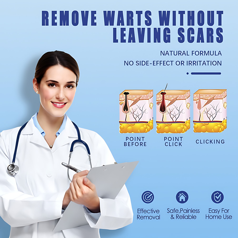 Tahi lalat remover Buang tahi lalat Buang kutil skin tag remover Remove ...