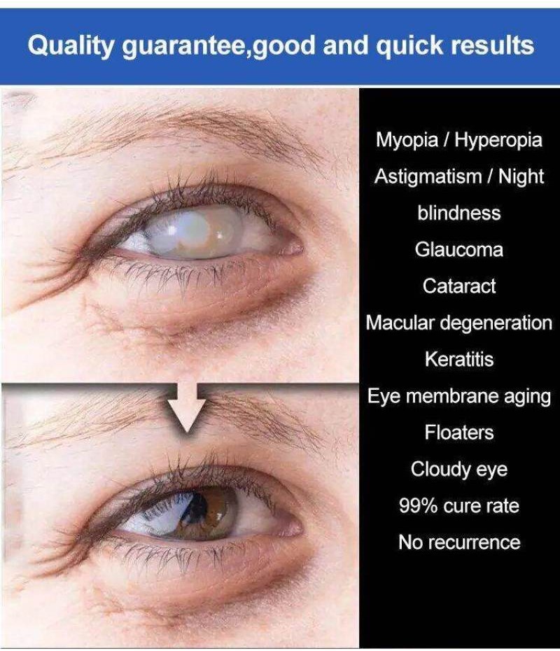 Eye Drops Japan Spot Goods Astigmatism Short-sighted Asthenopia 10ml ...