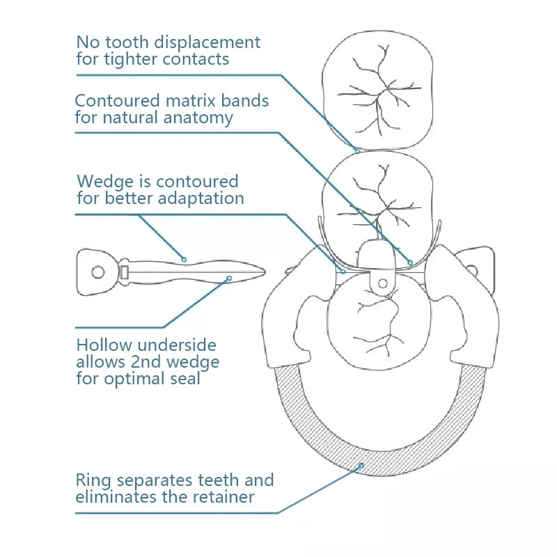 Dental Matrix Bands Matrix Ring Sectional Contoured Matrix System NiTi ...