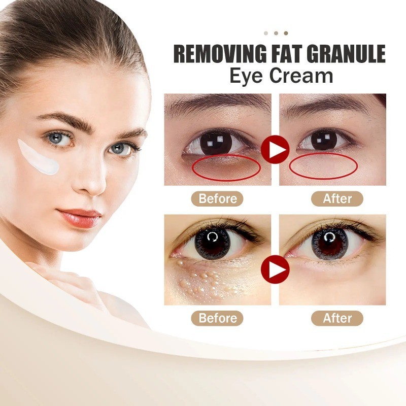EELHOE Fat Granules Eyes Cream Eye Bag Anti-Puffiness Moisturizing ...