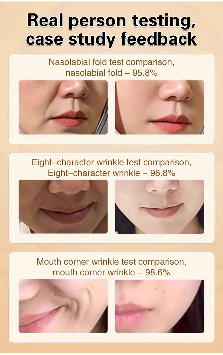 Hyaluronic Acid Anti-Wrinkle Sleep Patches/Collagen Against Wrinkles ...