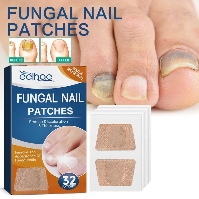 EELHOE Paronychia Treatment Patch Anti Infection Onychomycosis Reduce ...