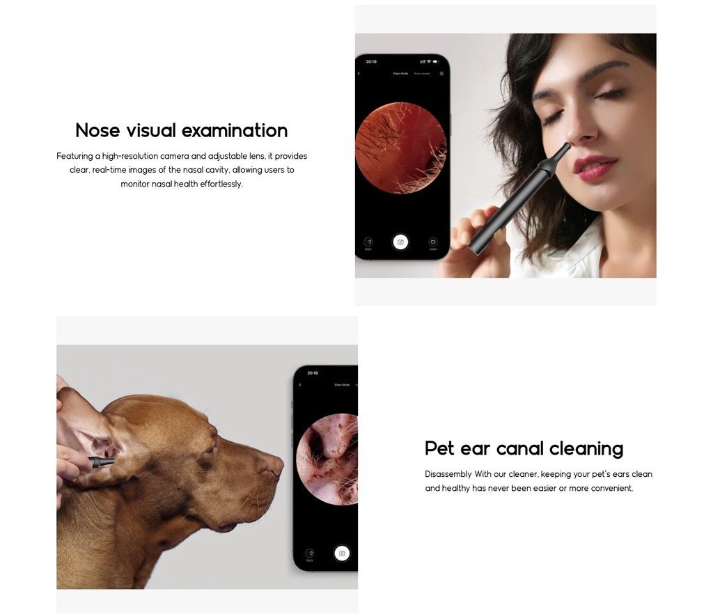 Bebird Home 30S 4-in-1 Smart Versatile Ear Camera with Fuild ...