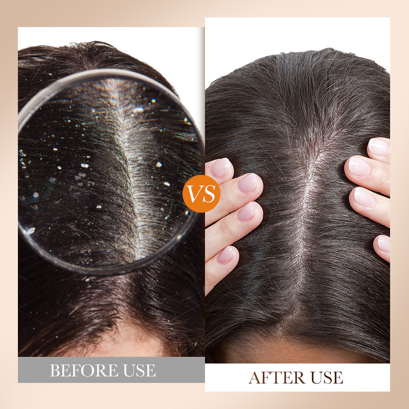 ROREC SADOER Argan Oil Full Range All Series Smooth Anti-Dandruff Anti ...